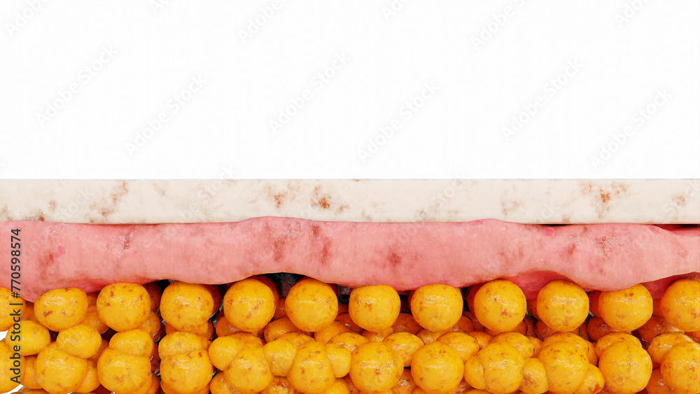 Weight loss Comparison. man body transformation. Before and after a ...