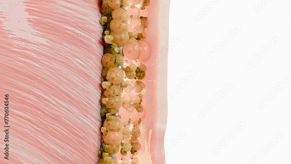 Weight loss Comparison. man body transformation. Before and after a ...