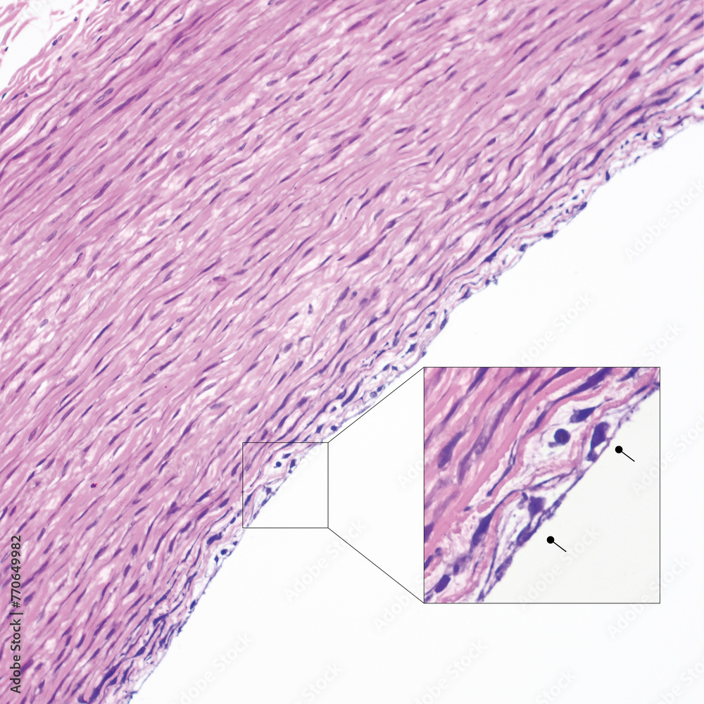 This photo shows simple squamous epithelial cells on the surface of the ...