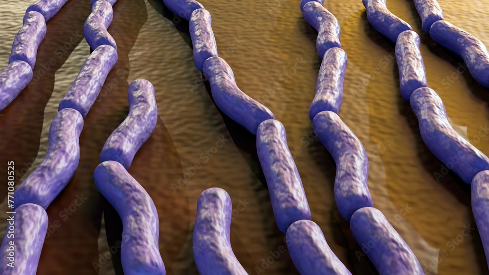 Anthrax is a fatal bacterial disease caused by the Bacillus anthracis ...