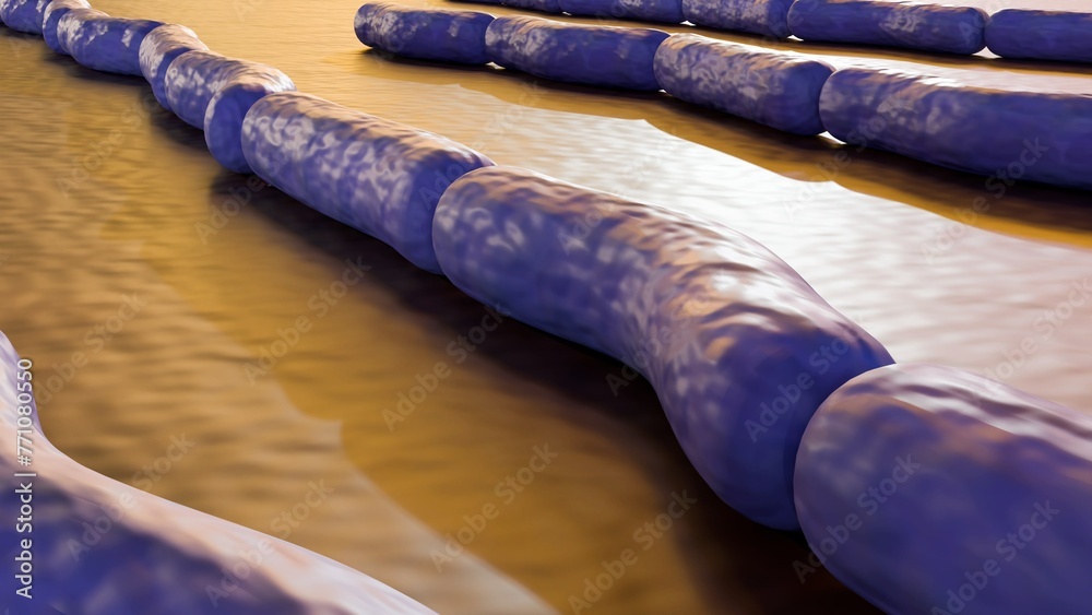 Anthrax is a fatal bacterial disease caused by the Bacillus anthracis ...