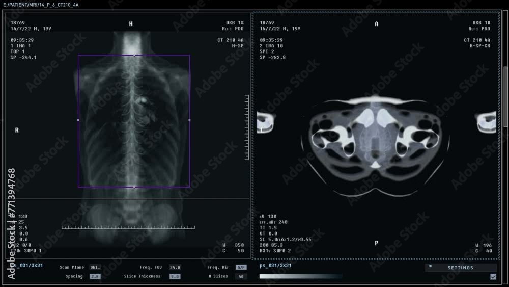 X-ray scanning medical exam analysis at the modern healthcare facility ...
