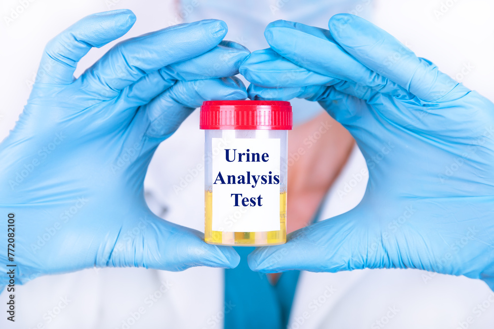 Laboratory sample of urine for drugs or substance test. Drug test is ...