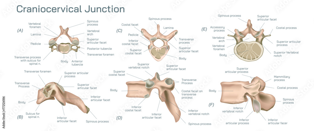 Craniocervical or craniovertebral Vector illustration, junction ...