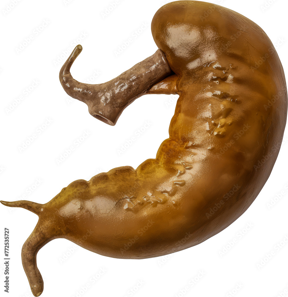 Detailed human pancreas model with ducts cut out on transparent ...