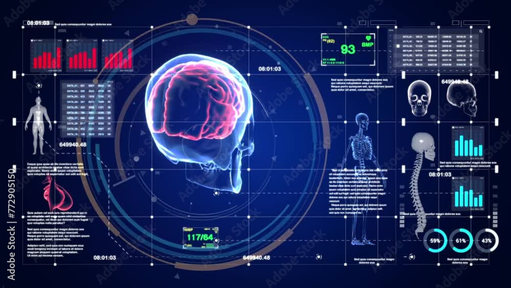 A computer monitor displays a brain and a skeleton. The brain is shown ...