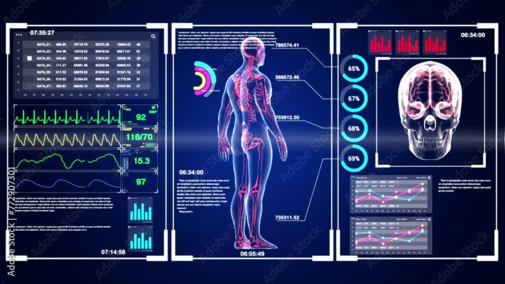 A computer monitor displays a human body with a heart and a skeleton ...