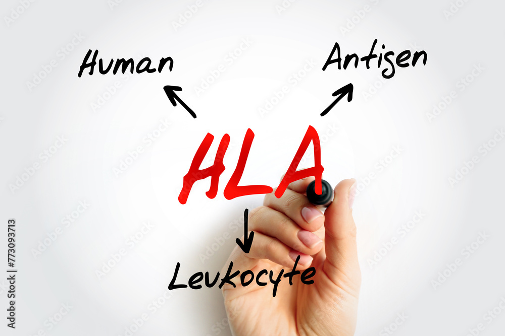 HLA Human Leukocyte Antigen - complex of genes on chromosome 6 in ...