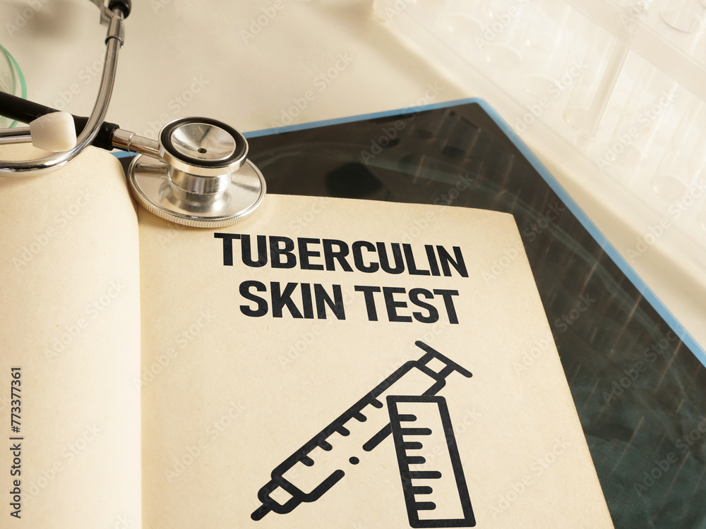 Tuberculin skin test is shown using the text Stock Photo | Adobe Stock