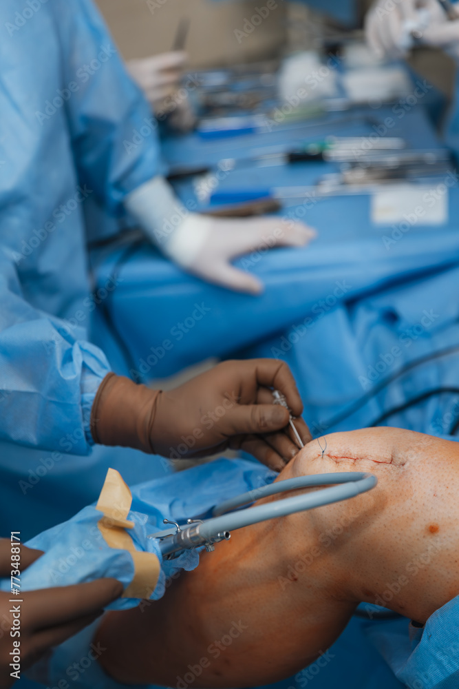 Surgeon perform total knee replacement surgery. Incision was made on ...