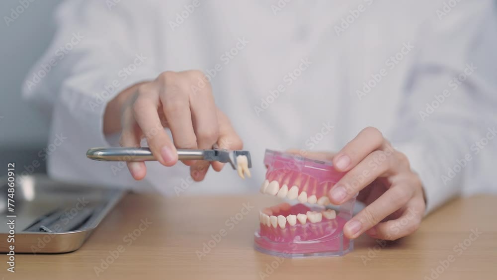 Dentist with tooth Anatomy model. Oral Teeth and disease, Scrape off ...