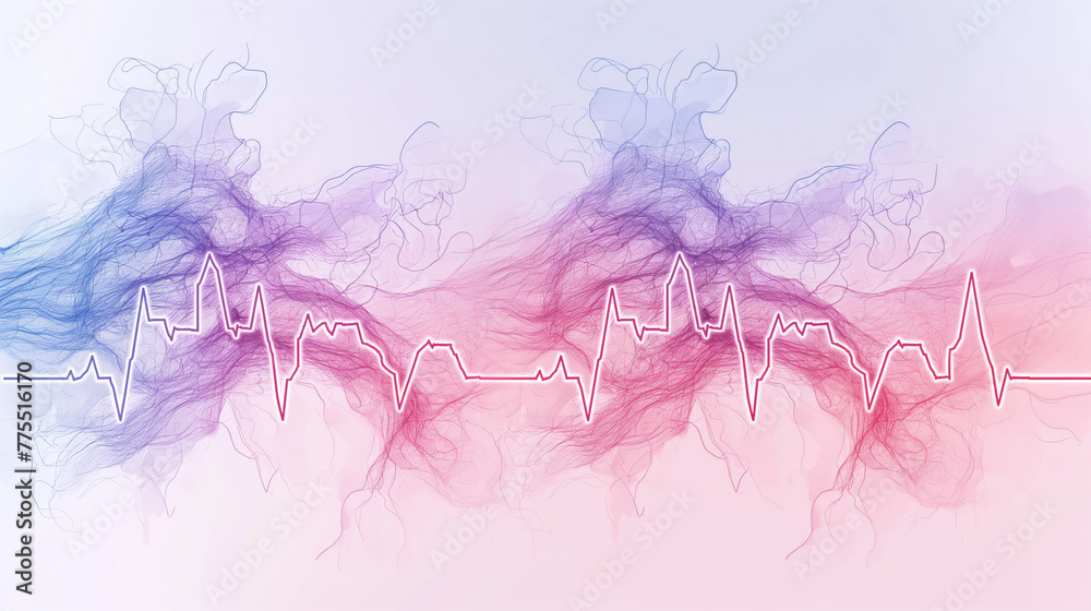 Illustration of an electrocardiogram (ECG or EKG) showing a normal ...