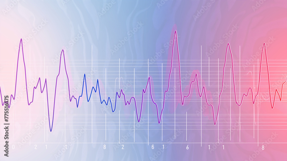 Illustration of an electrocardiogram (ECG or EKG) showing a normal ...