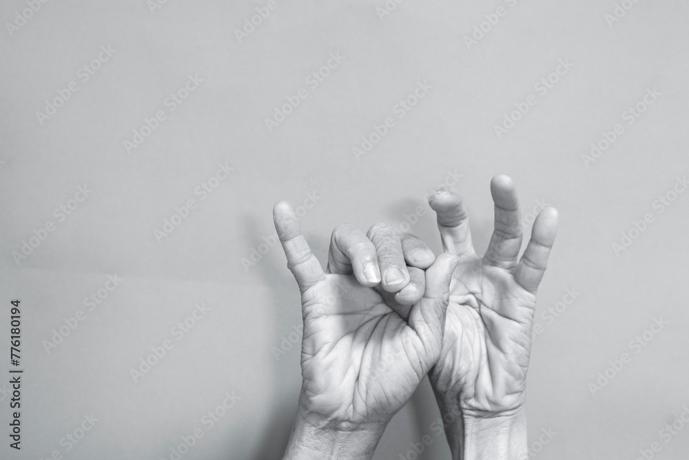 Symptoms of arthritis in the hands cramps in fingers or feel pain and ...