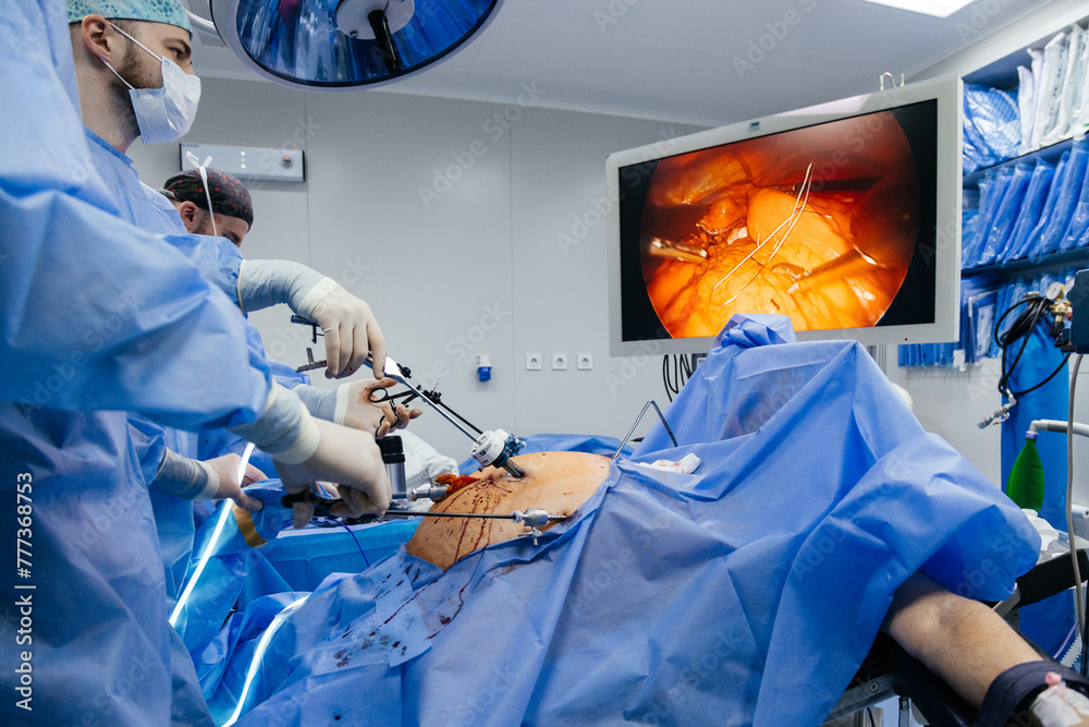 Liposuction surgery. The doctor prepares to collect fat from the woman ...