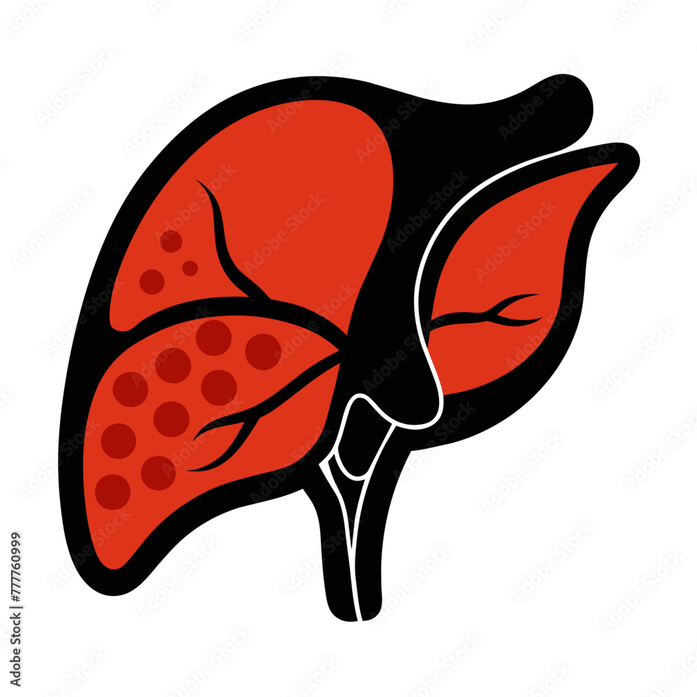 Human Liver Isolated on White Background Detailed Anatomy Image Stock ...