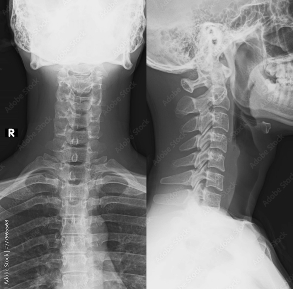 Poster normal human cervical xray – Wall Art | UkPosters
