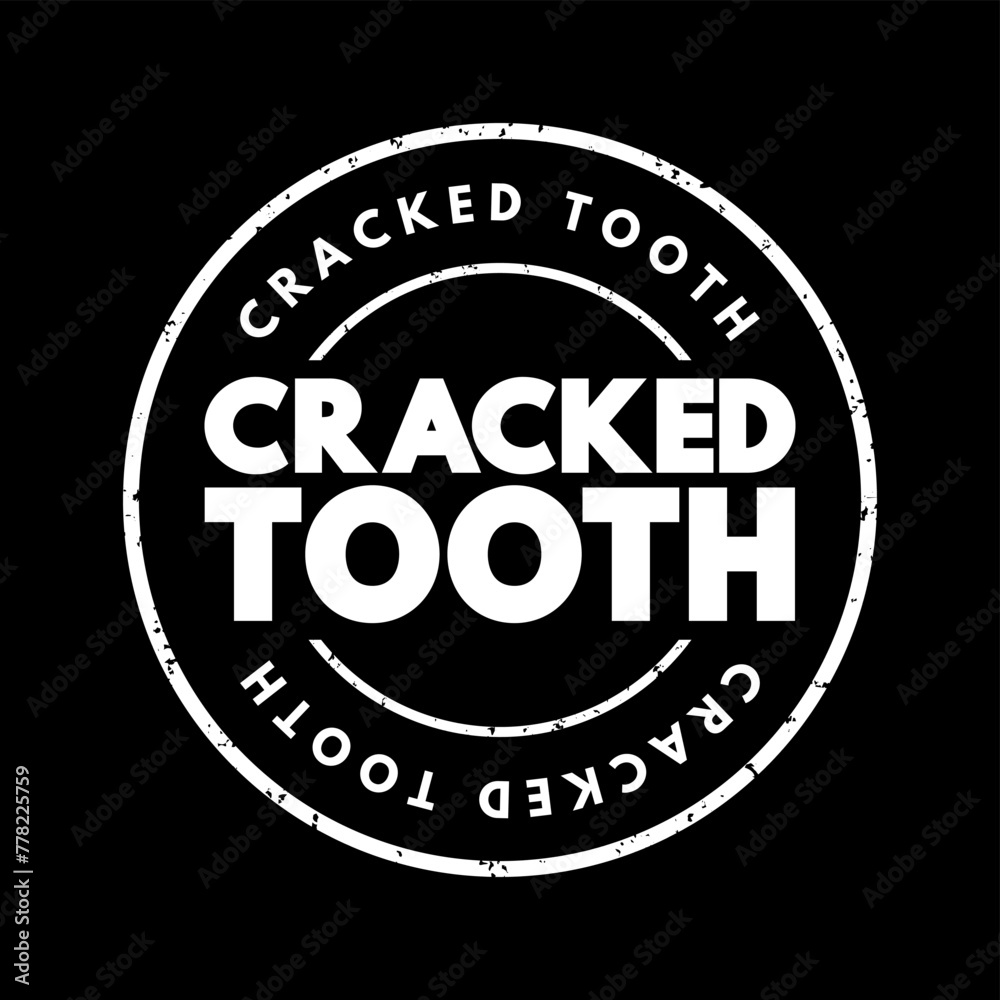 Cracked Tooth - a condition where a tooth has developed one or more ...