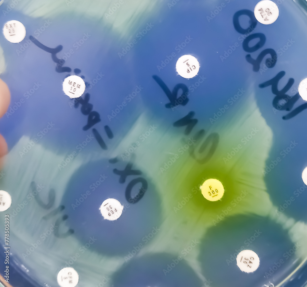 Antimicrobial susceptibility testing, Pseudomonas aeruginosa in culture ...