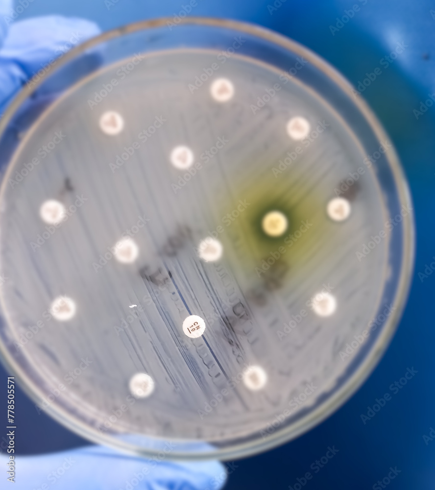 Antimicrobial susceptibility testing in culture plate. Drug sensitivity ...