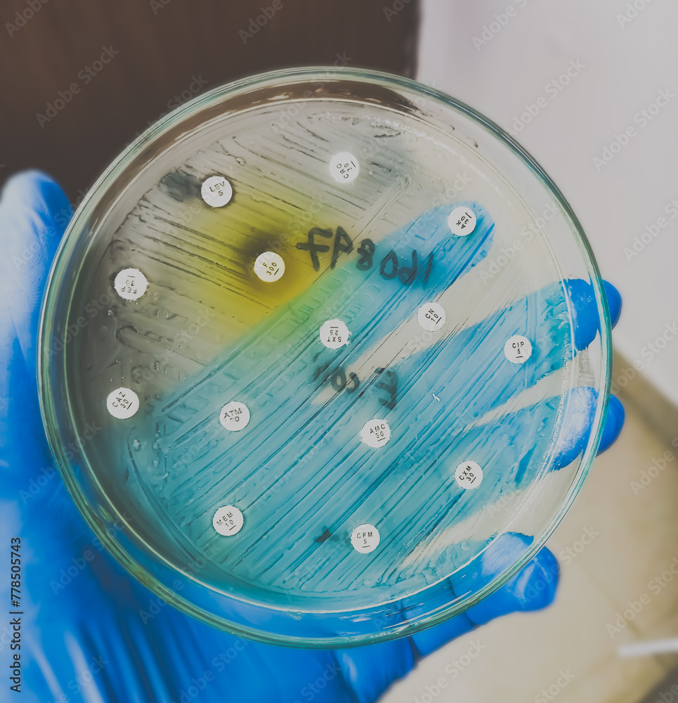 All antibiotic are resistance. Antimicrobial susceptibility testing in ...