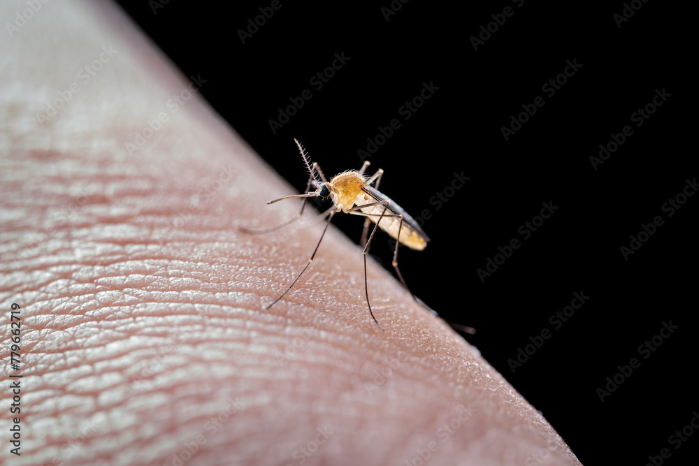 Dangerous Zika Infected Mosquito Skin Bite. Leishmaniasis, Encephalitis, Yellow Fever, Dengue ...