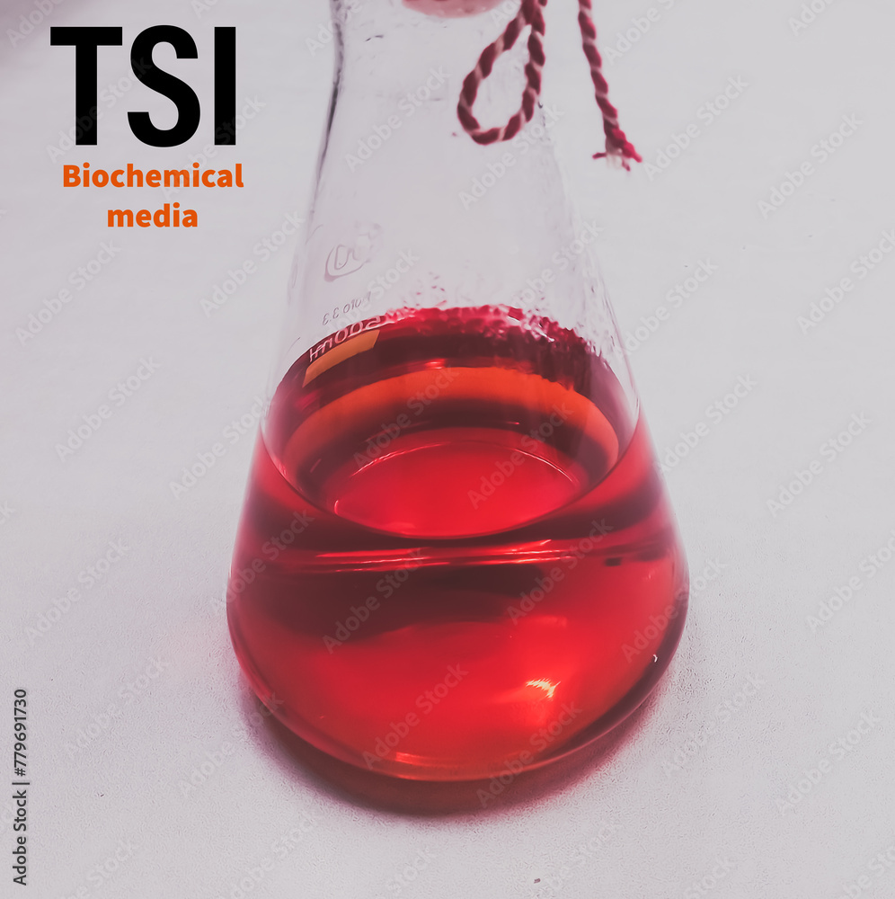 Biochemical test in microbiological liquid media. Blood agar plate ...