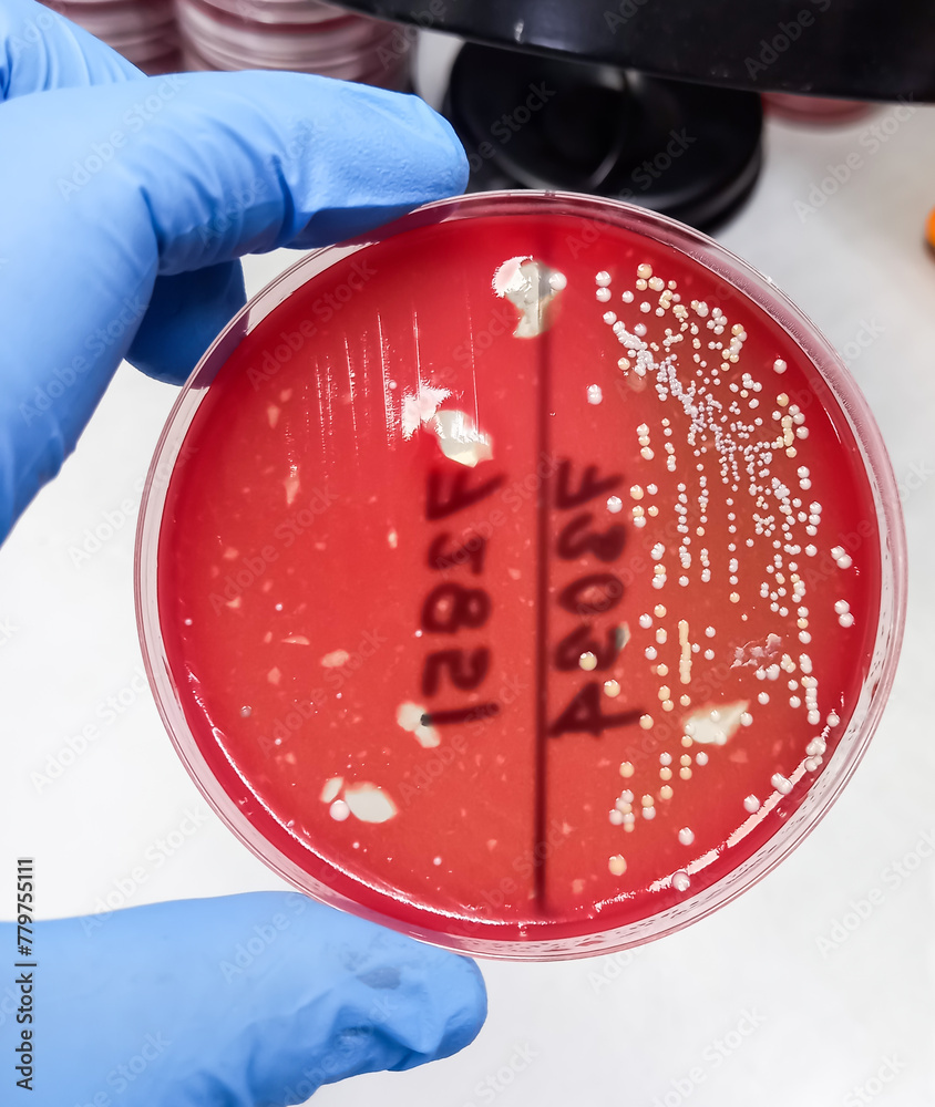 Streptococcus bacterial colonies with beta hemolytic on blood agar ...