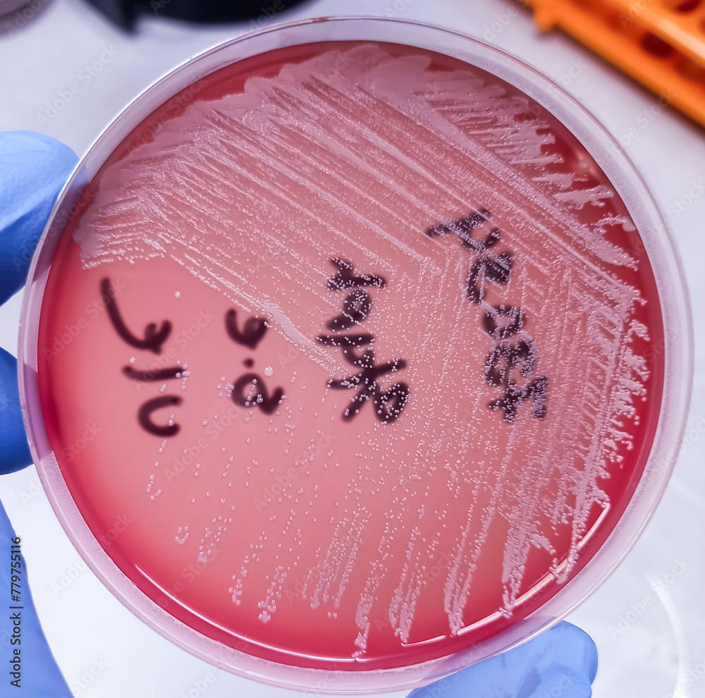 Streptococcus bacterial colonies with beta hemolytic on blood agar ...