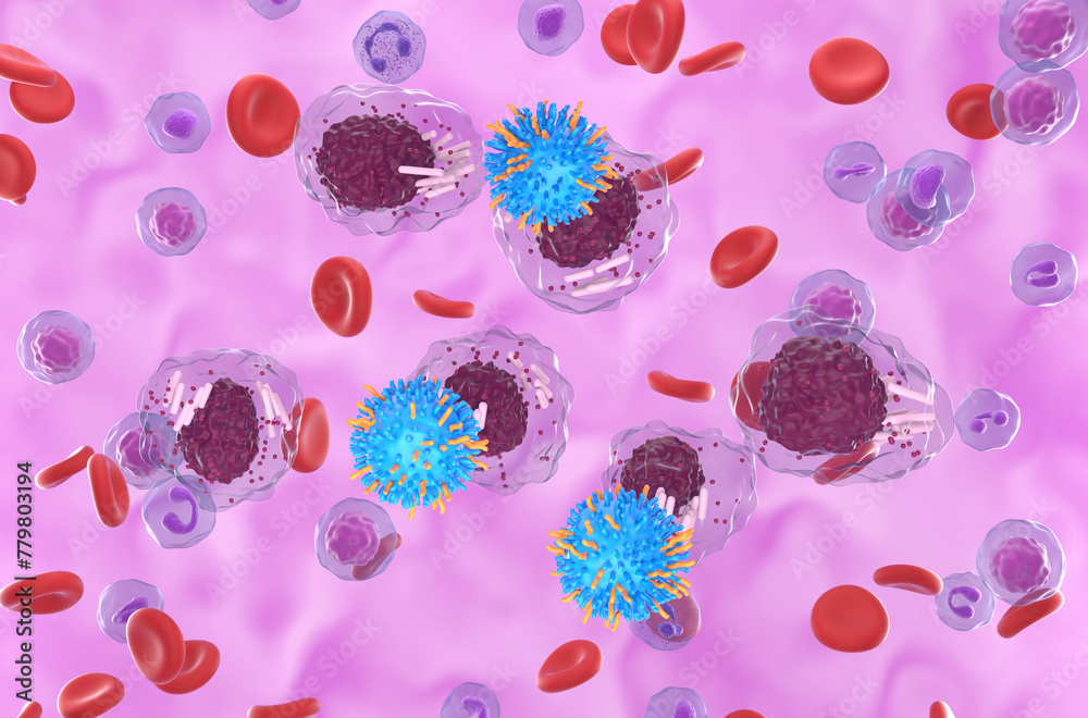 CAR T cell therapy in Chronic lymphocytic leukemia (CLL) - isometric ...