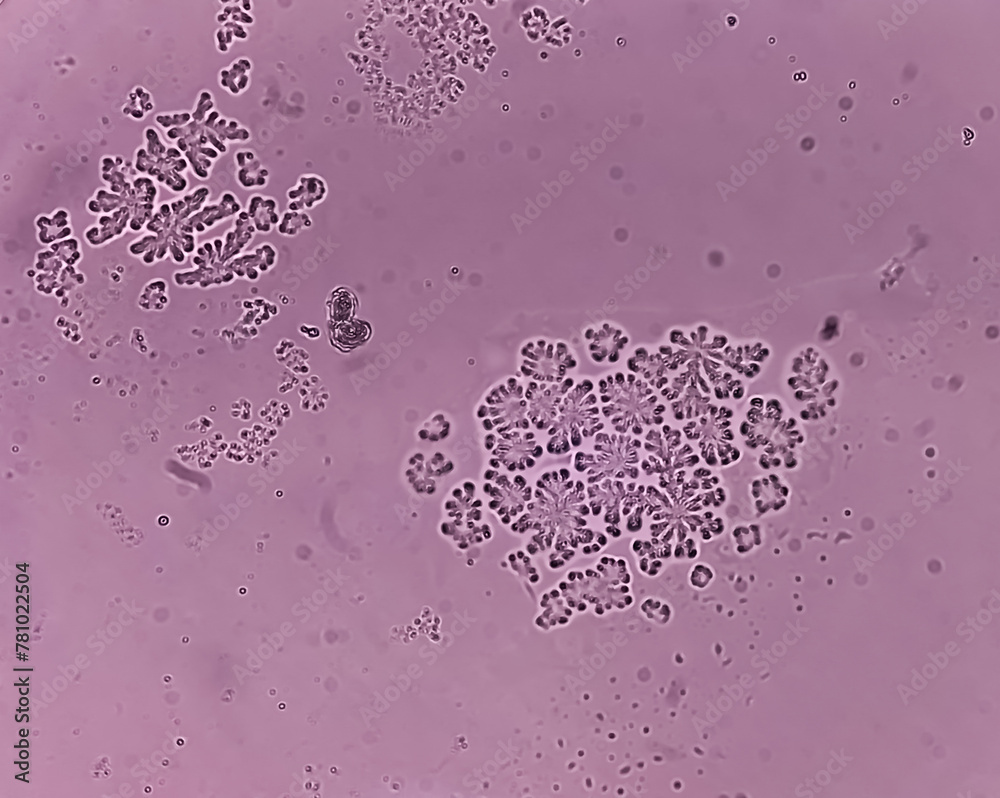 Microscopic fungi Malassezia furfur, showing yeast cells and hyphae ...