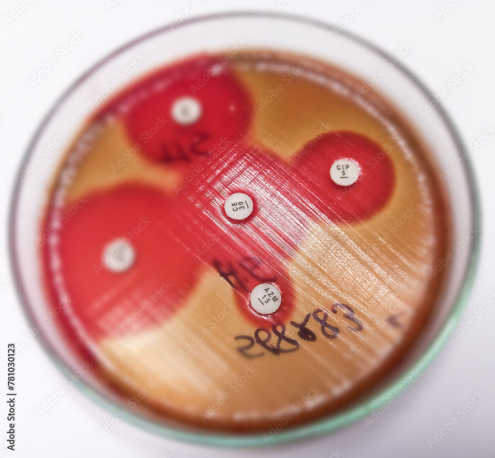 Antimicrobial susceptibility testing in petri dish,Gram-positive coccus ...
