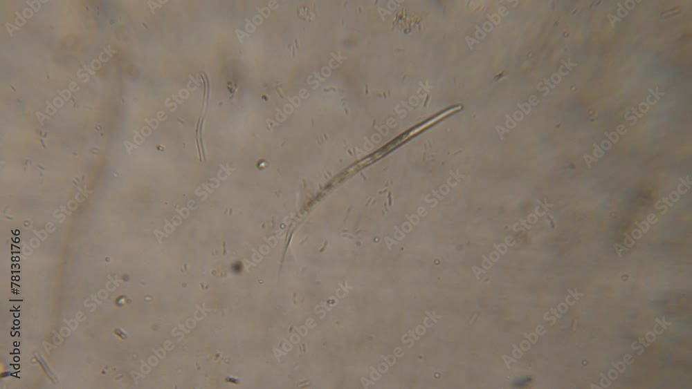 Bacteria Parasites and Worms in drinking Water under Microscope ...