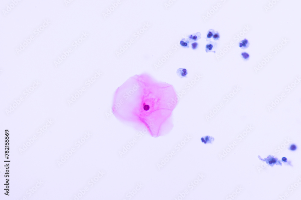 View in microscopic of human skin cells.Squamous epithelium cells ...