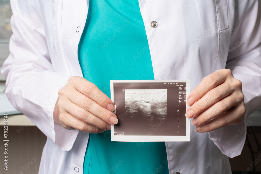 Gynecological ultrasound in doctor's hands, ensuring proper prenatal ...