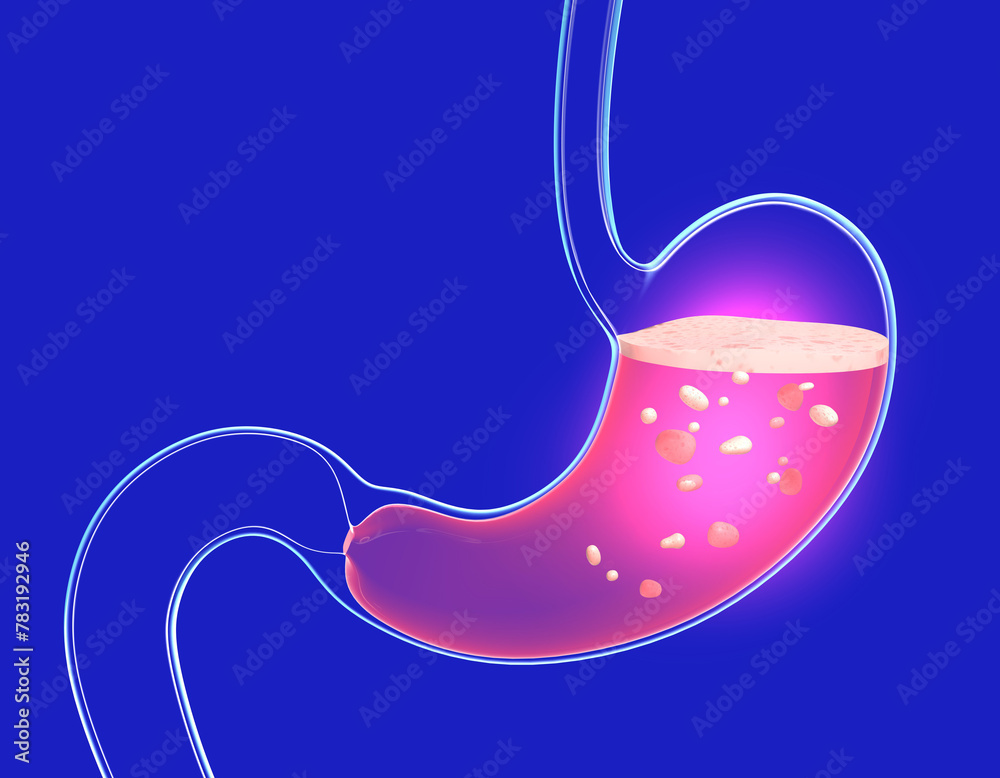 3D illustration of stomach digesting with burning and heaviness ...