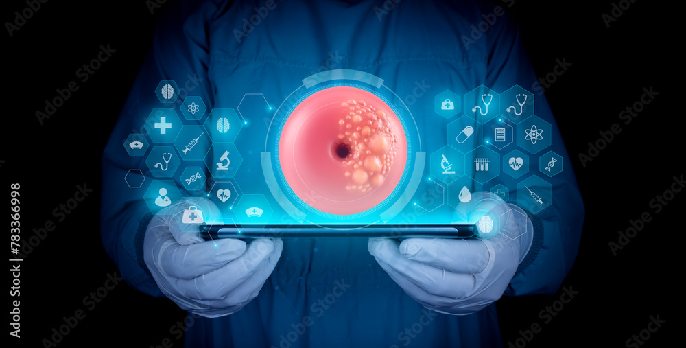 Cervical cancer seen from a speculum. Hologram of the cervix. The ...