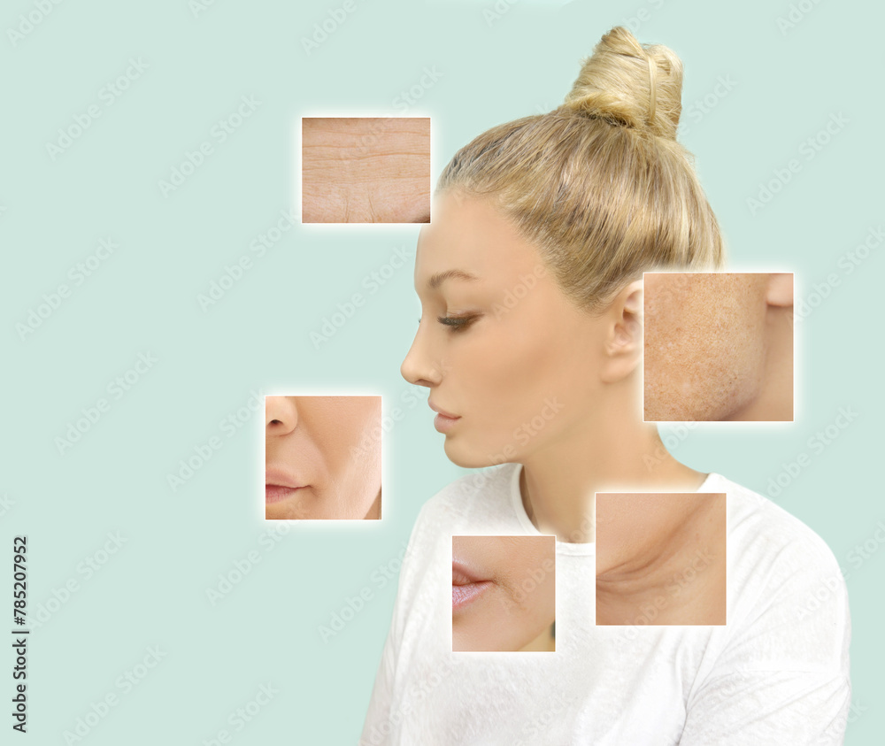 Signs of skin aging,signs of premature aging, Wrinkles and fine lines ...