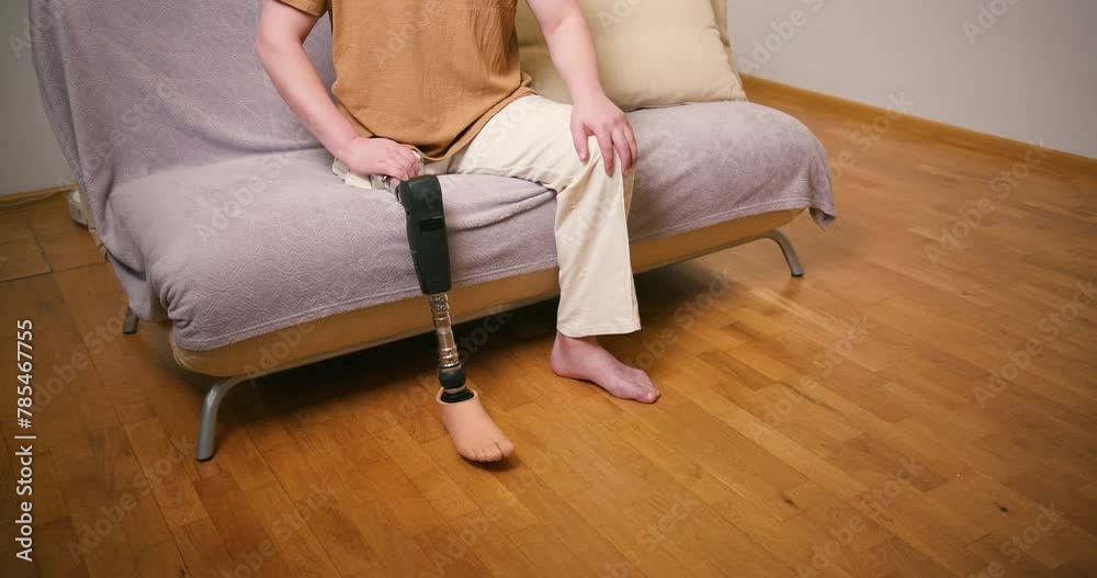 Close up of man amputee with prosthetic leg disability on above knee ...