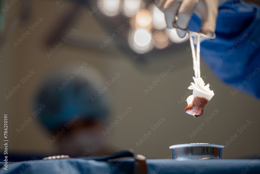 Hand of surgery doctor in Operating Room hold operating plier forceps ...