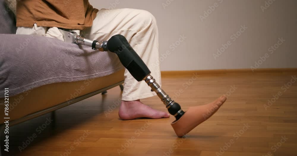 Close up of man amputee with prosthetic leg disability on above knee ...