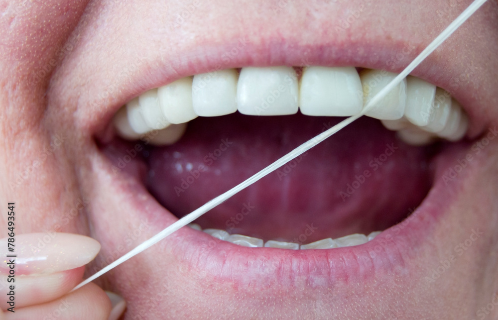 Closeup woman flossing perfect white teeth with floss toothcare hygiene ...