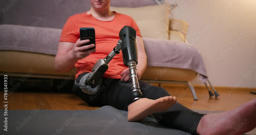 Man amputee with prosthetic leg disability on above knee transfemoral ...
