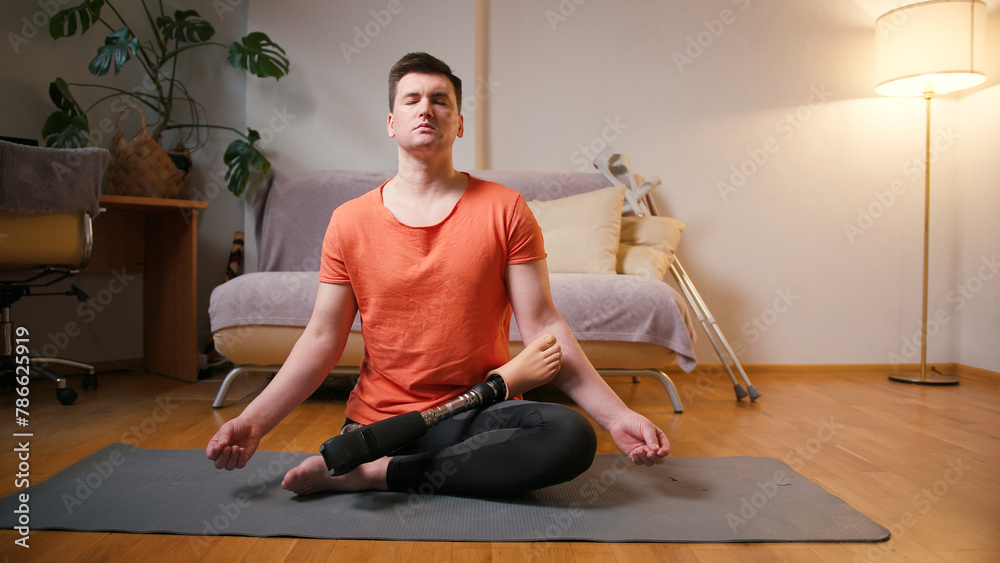 Man amputee with prosthetic leg disability on transfemoral leg ...