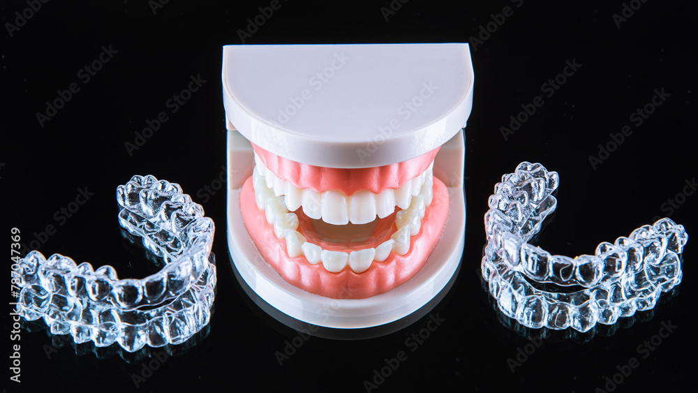 Invisible and removable aligner trays for teeth straightening with ...