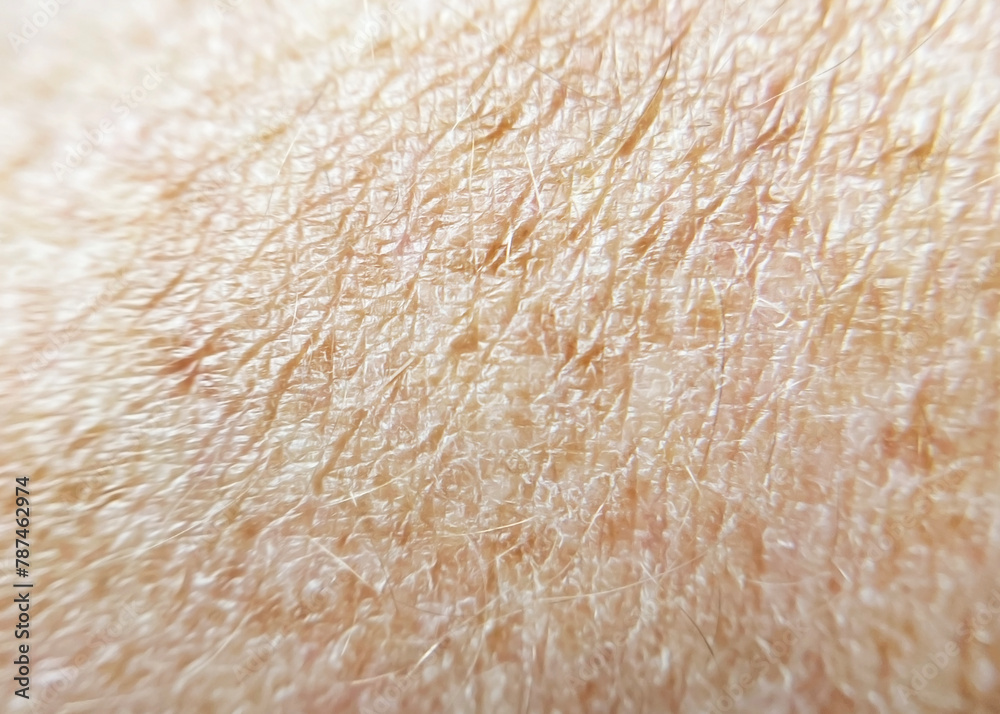 human skin texture with hairs and small pigment spots close-up Stock ...