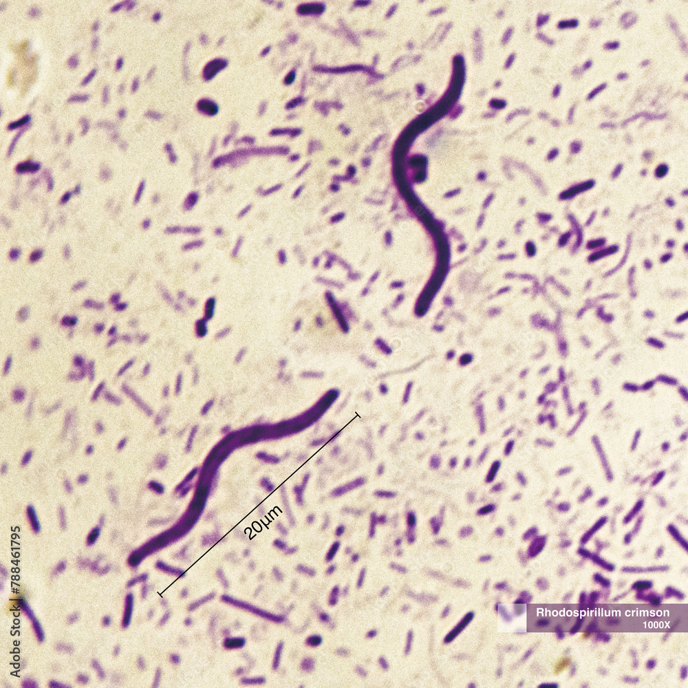Crimson red spirochetes is a spiral shaped bacterium that is Gram ...