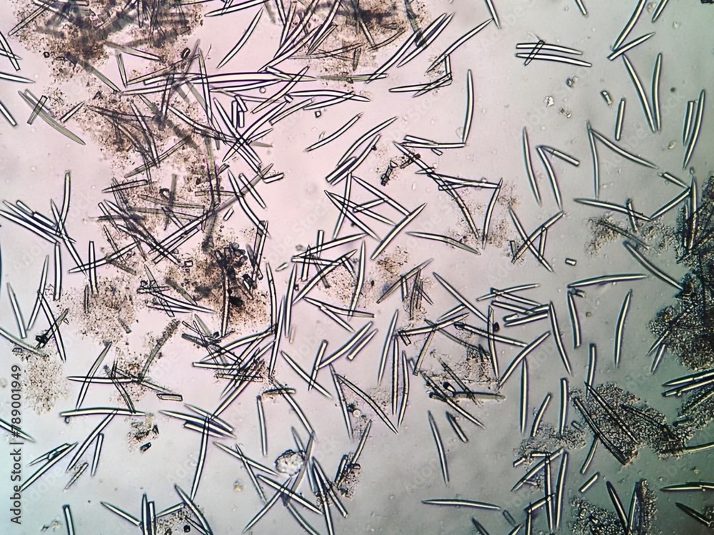 Spicules in porifera is the structure that supports porifera's body ...
