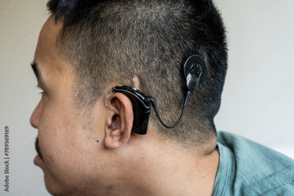 Side profile portrait of a Gen Z guy with a cochlear implant Stock ...