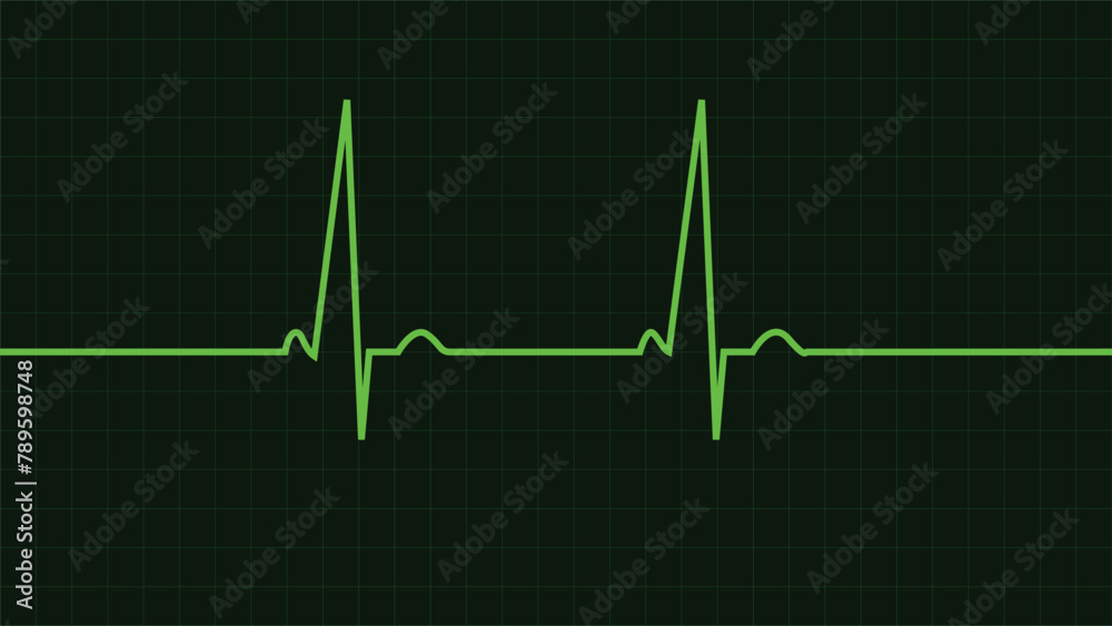 Heart Beat Line, cardiogram line, heart pulse, Heart wave monitoring ...